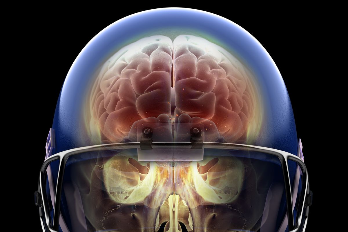 Concussion Wallpapers - Wallpaper Cave
