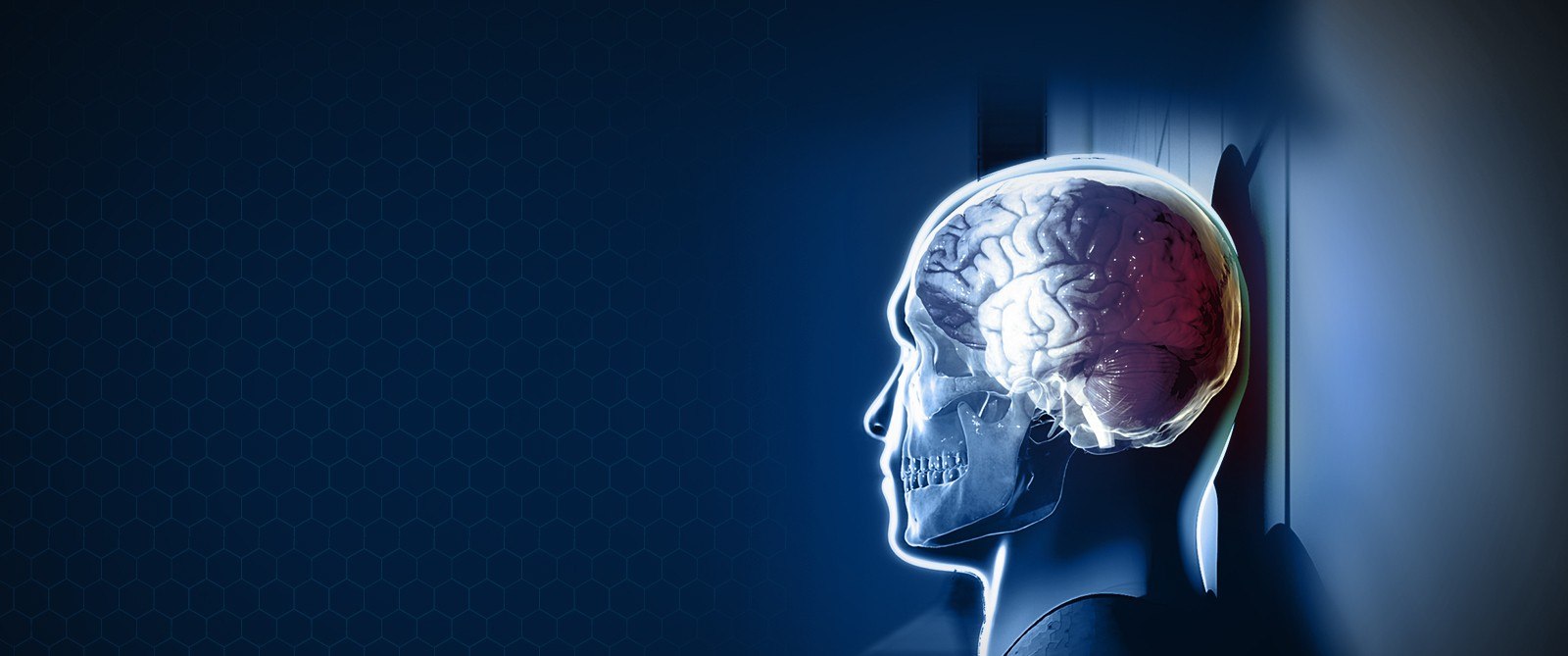 Concussion Wallpapers - Wallpaper Cave