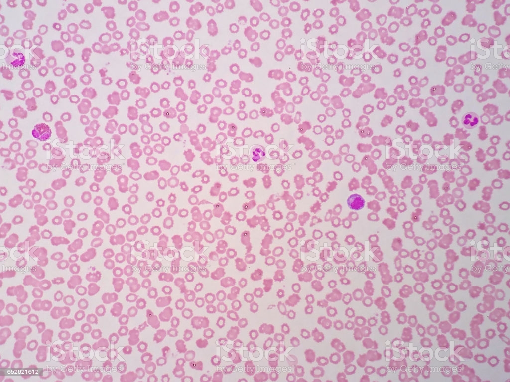 Human Blood Wallpapers - Wallpaper Cave