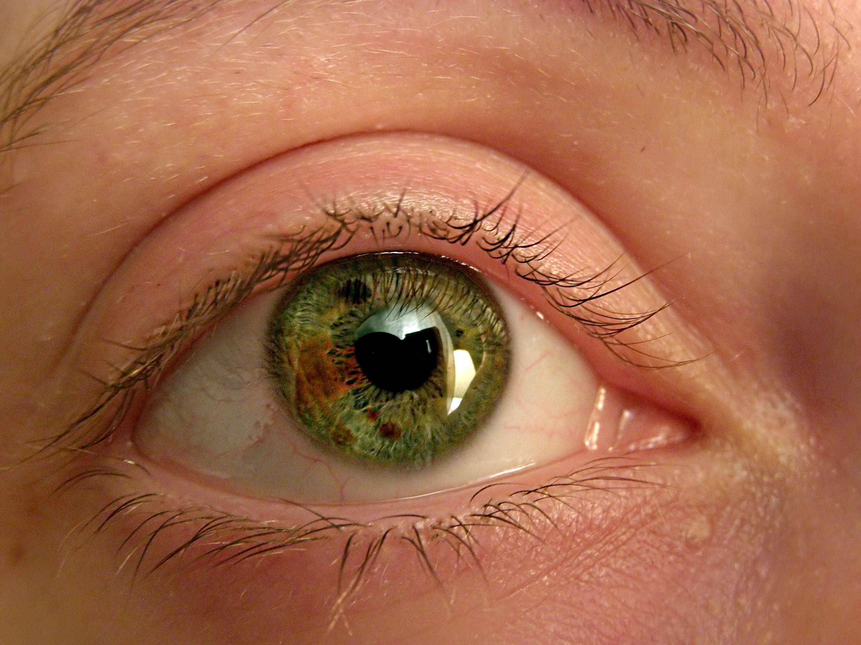 Heterochromia Wallpapers - Wallpaper Cave