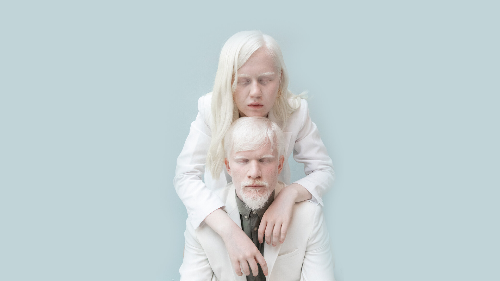 Albinism Wallpapers - Wallpaper Cave