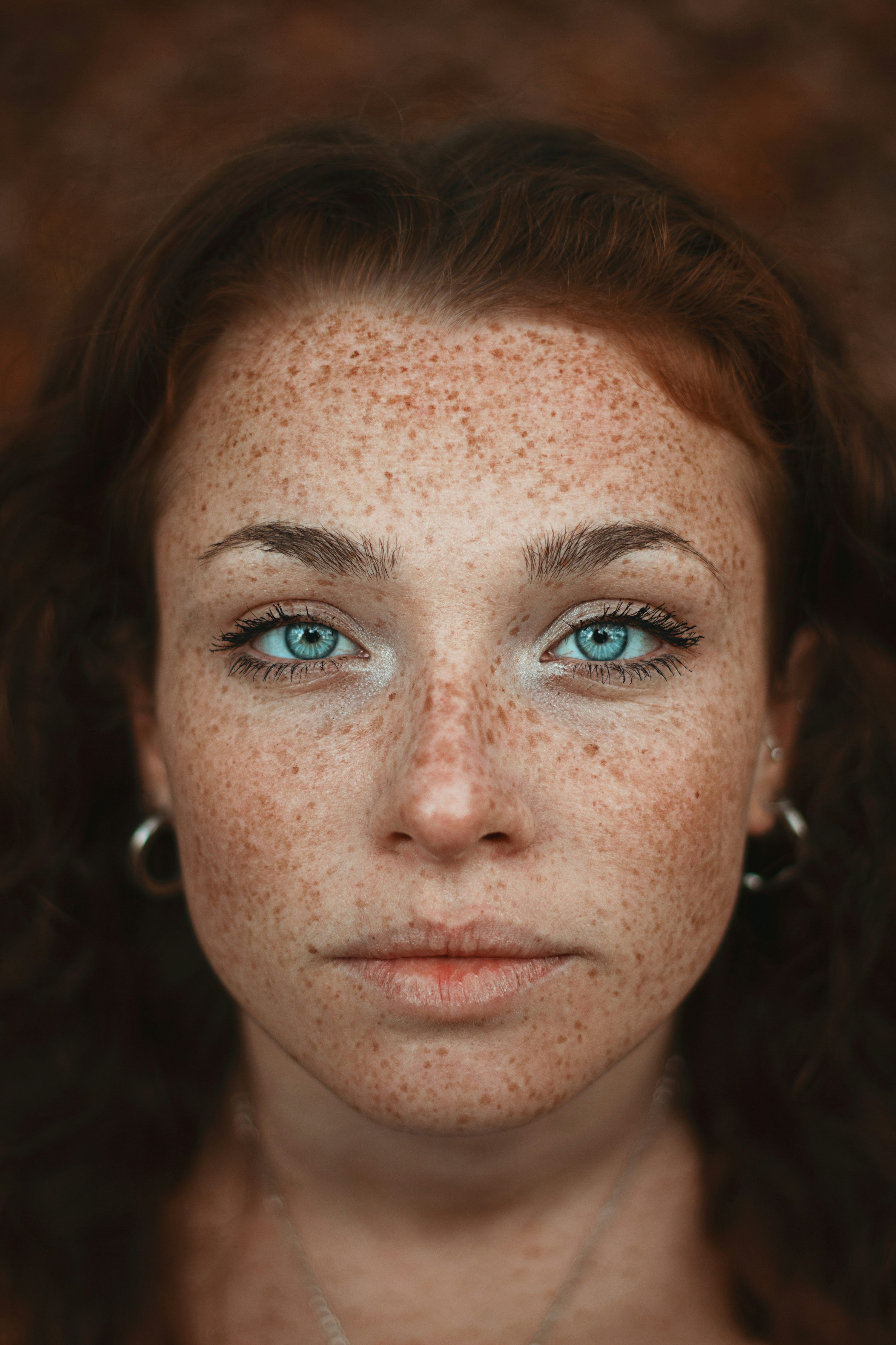 Hyperpigmentation Wallpapers - Wallpaper Cave