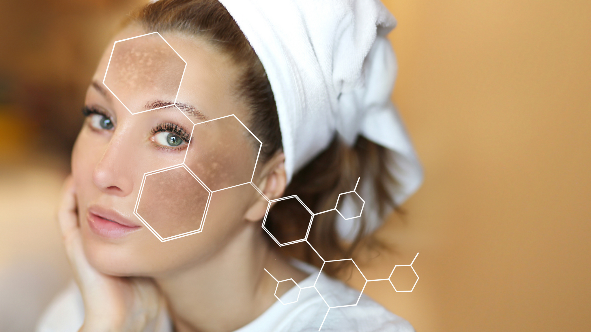 Hyperpigmentation Wallpapers - Wallpaper Cave