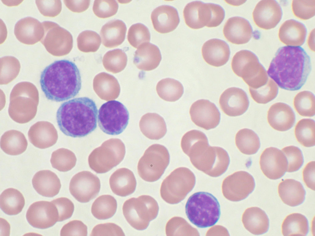 Leukemia Wallpapers - Wallpaper Cave