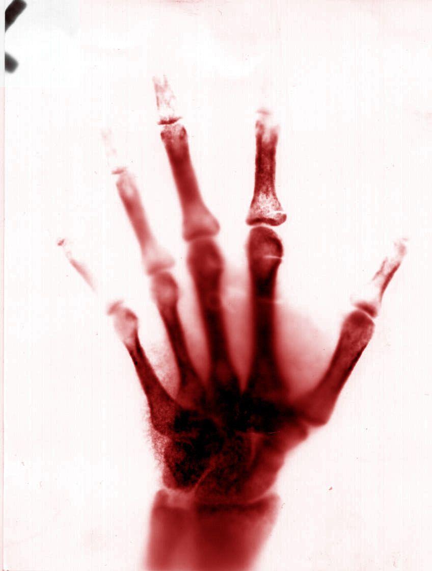 Blod Hand Wallpapers - Wallpaper Cave