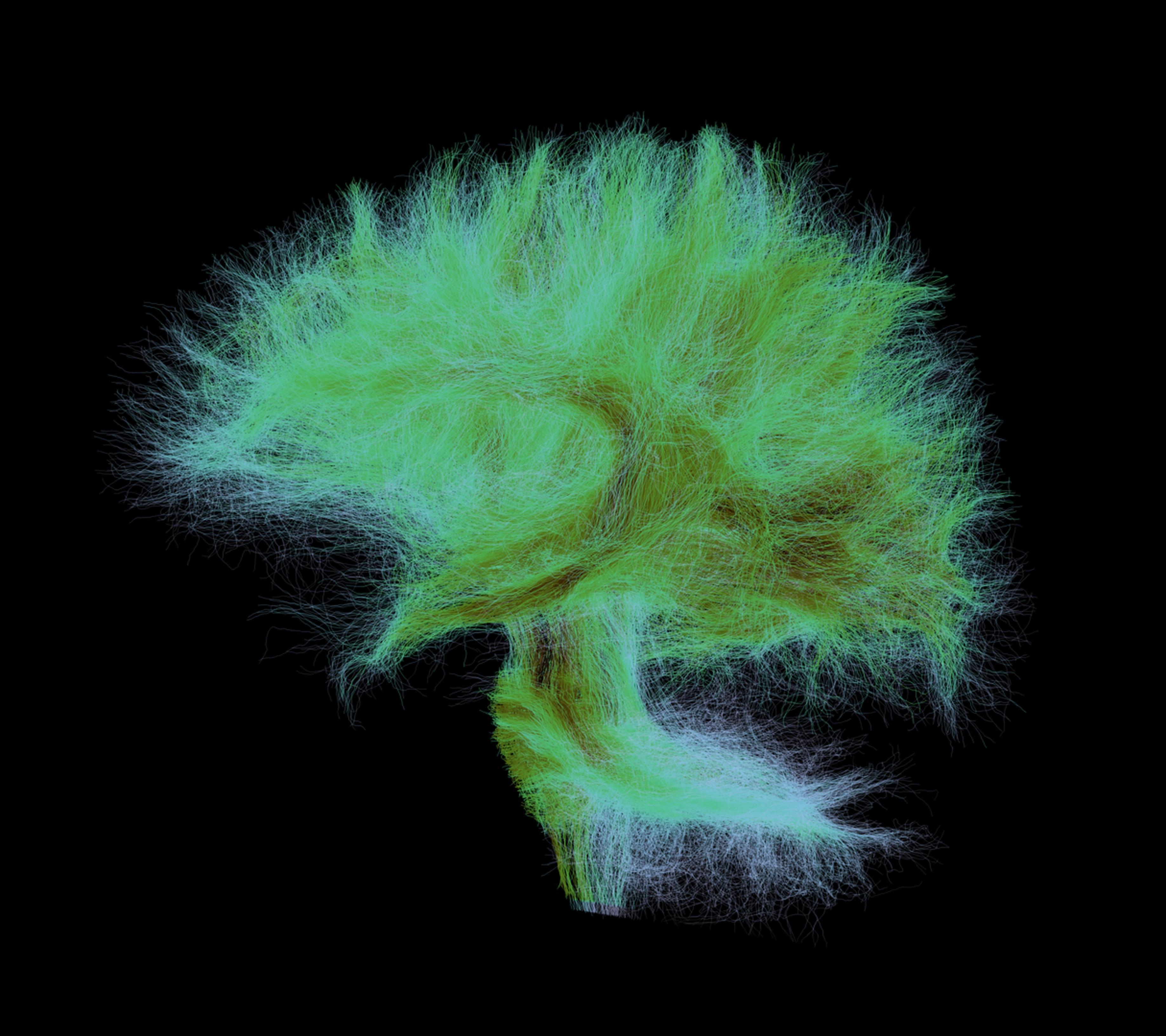 Neuralink Wallpapers - Wallpaper Cave