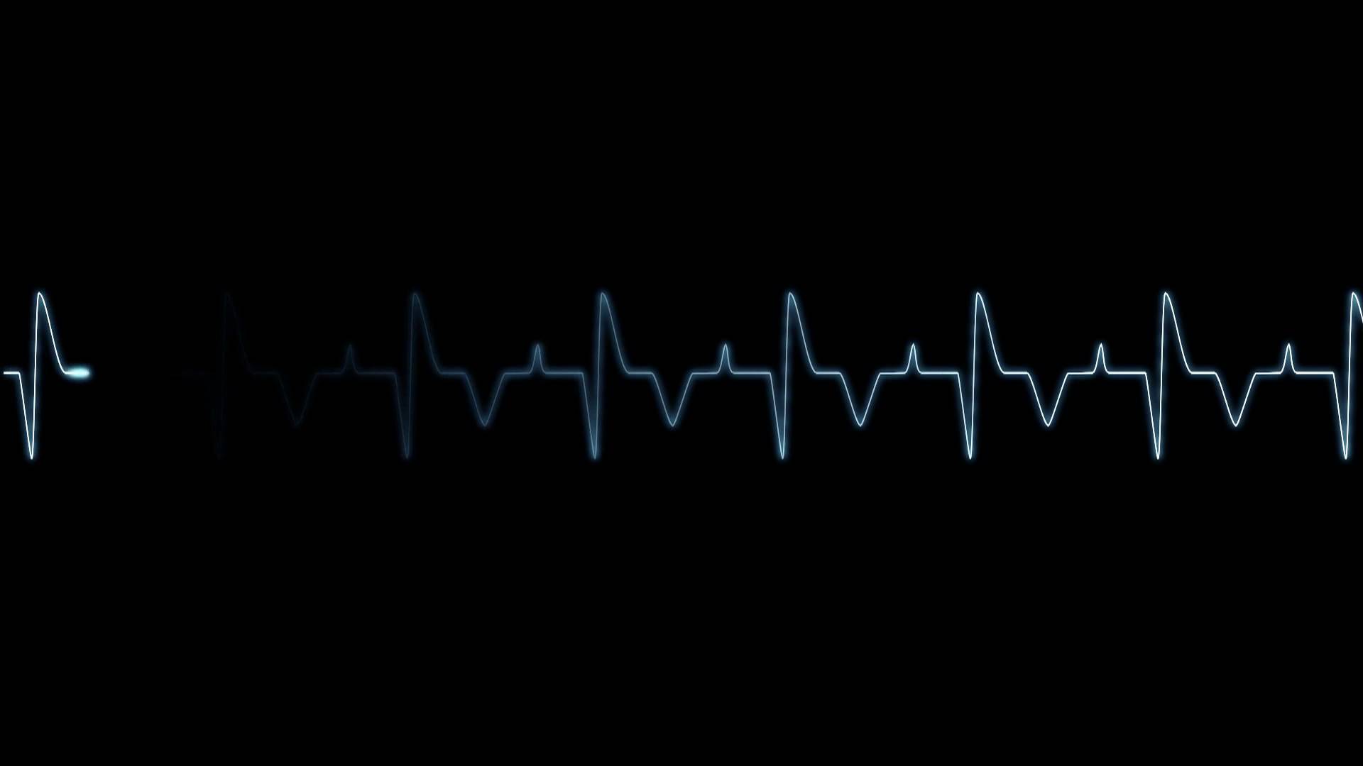 Ecg Wallpaper Hd Electrocardiogram