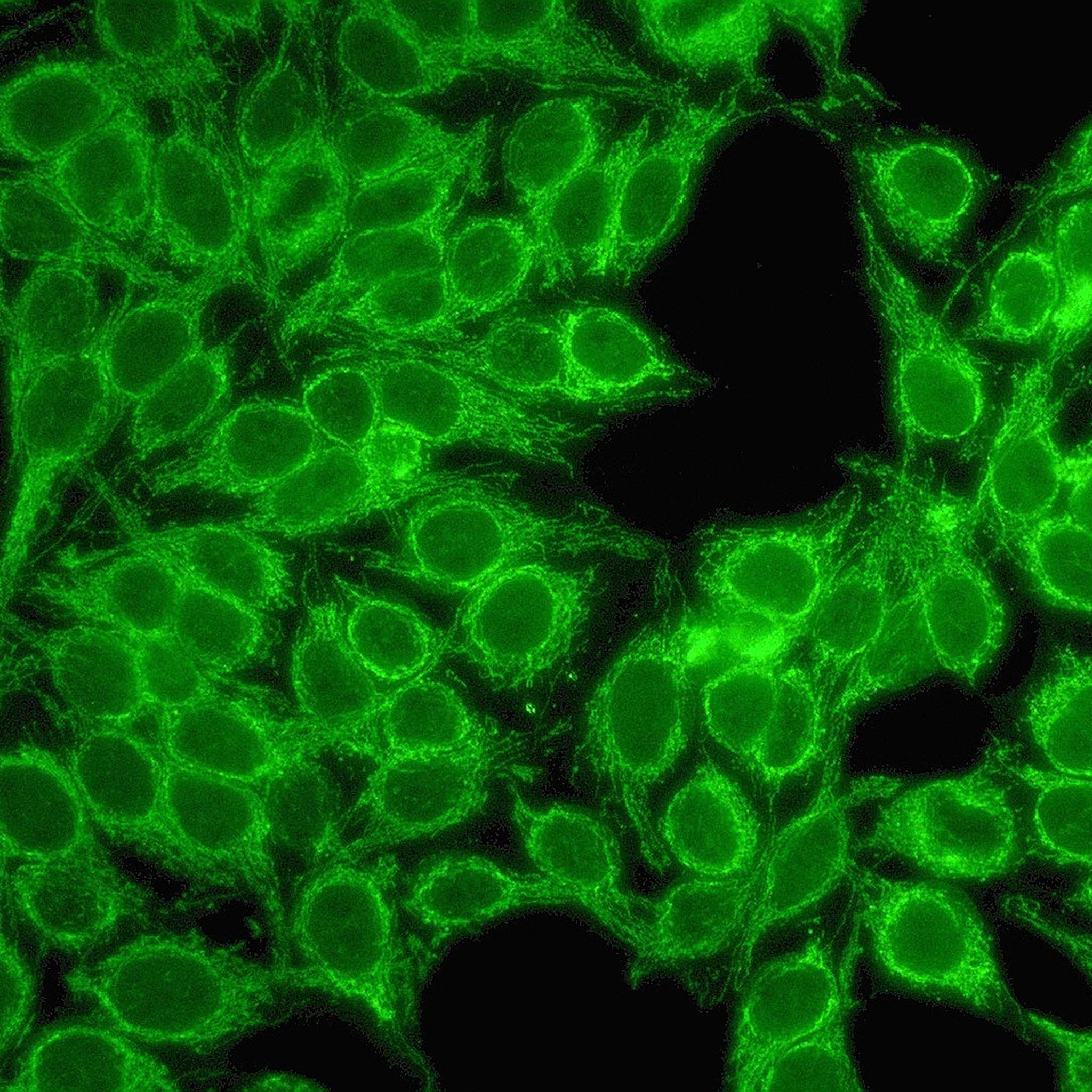 Pathology Wallpapers - Wallpaper Cave